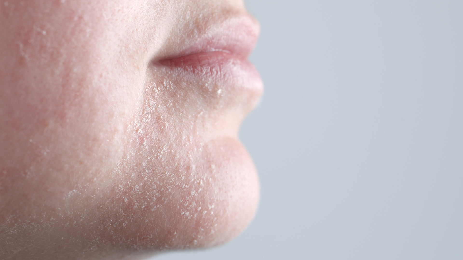 The Ultimate Guide to Healing a Compromised Skin Barrier – Skin & Bare ...